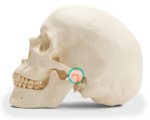 Jaw Surgery | Metroplex Surgical Arts | Dallas | Waxahachie