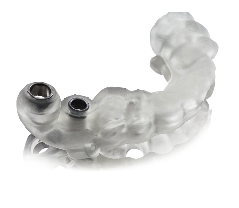 Guided Implant Surgery | Metroplex Surgical Arts